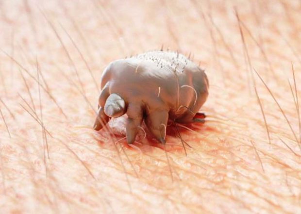 Cum se transmite scabia la om | Cunoaste lumea